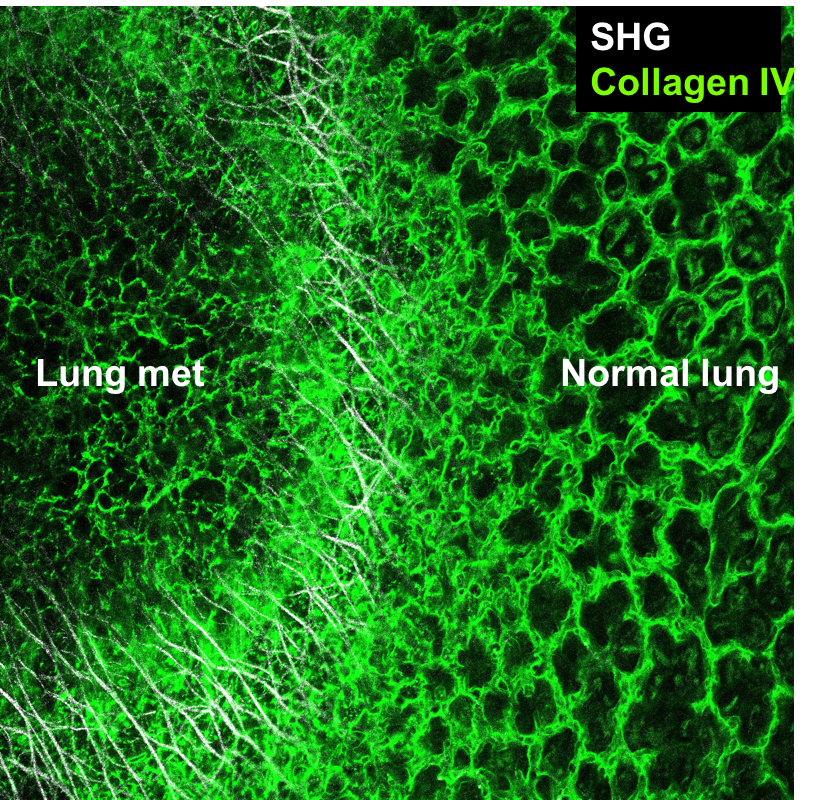 Matrix during cancer progression | erlerlab